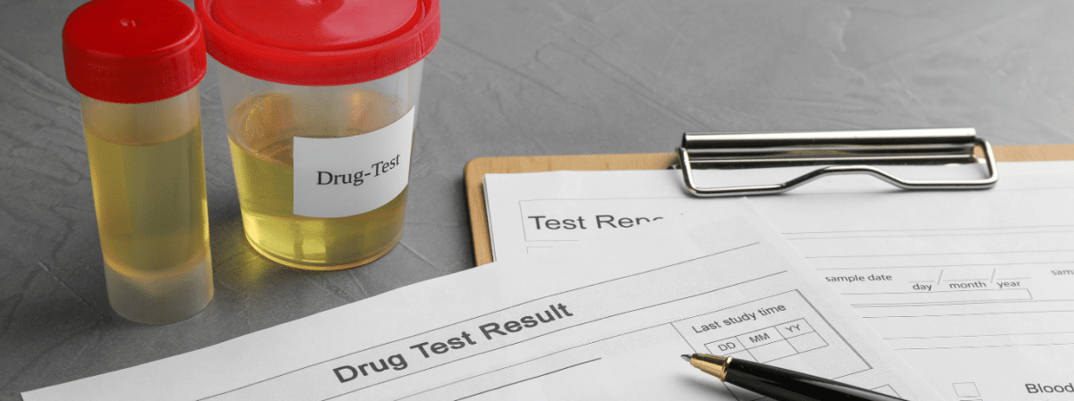 How To Drug Test Employees Legally & Compliantly